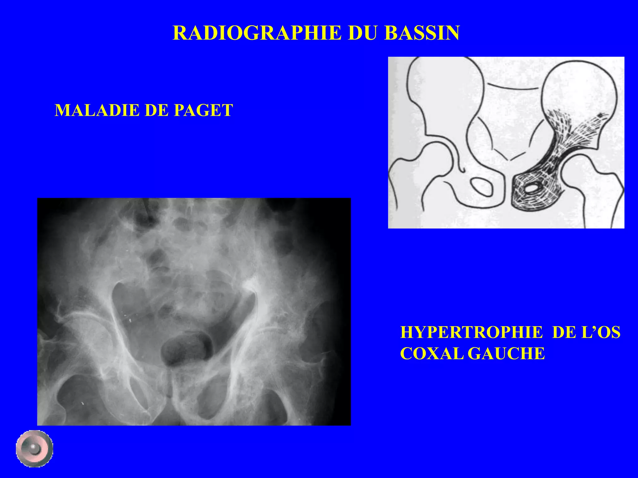 1 anatomie et semiologie rdiologique (version 2) | PPTX