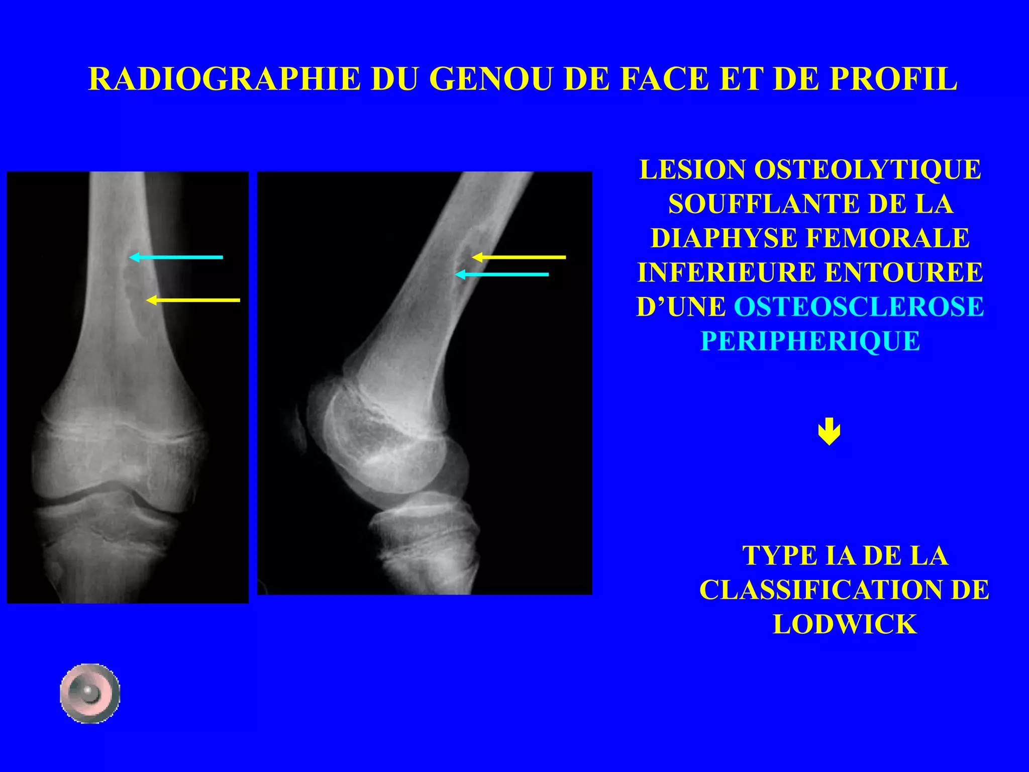 1 anatomie et semiologie rdiologique (version 2) | PPTX
