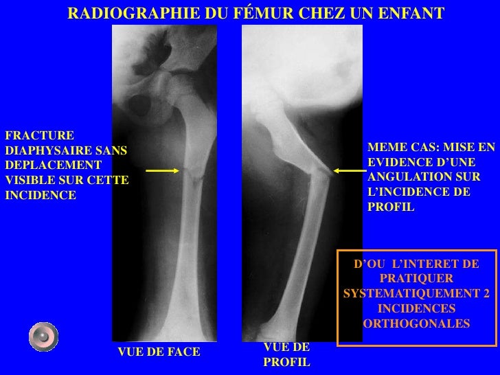 1 anatomie et semiologie rdiologique (version 2)