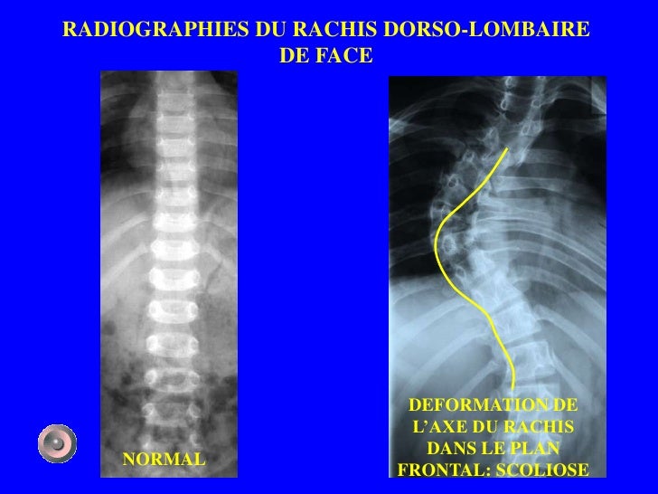 1 anatomie et semiologie rdiologique (version 2)