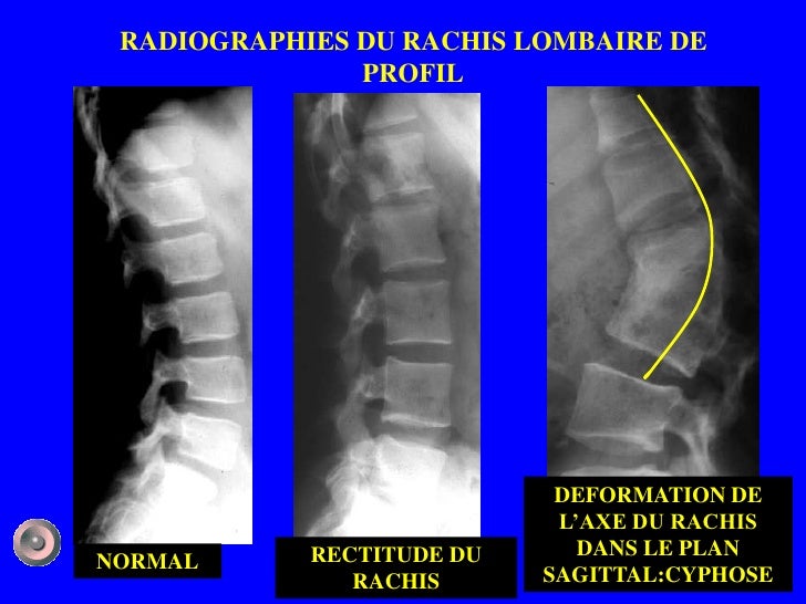 1 anatomie et semiologie rdiologique (version 2)