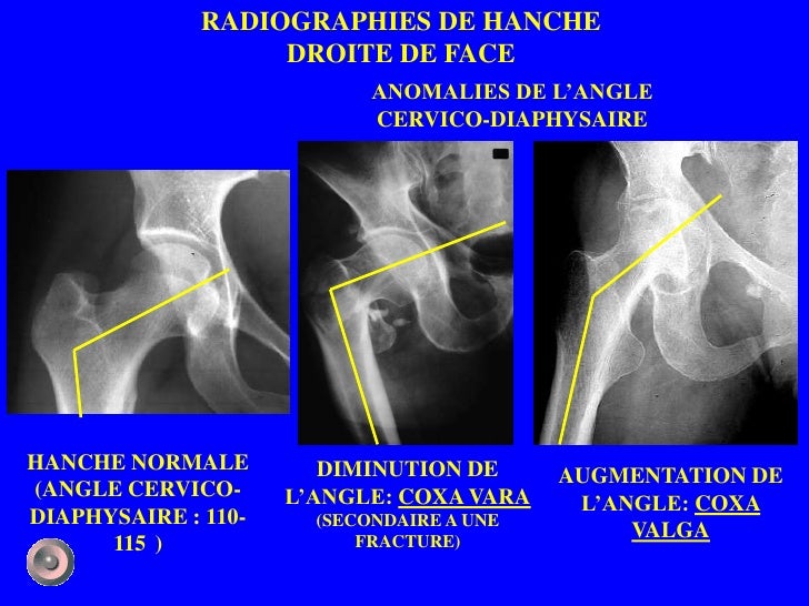 1 anatomie et semiologie rdiologique (version 2)