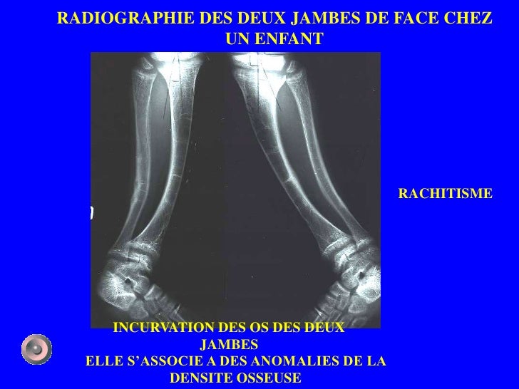 1 anatomie et semiologie rdiologique (version 2)