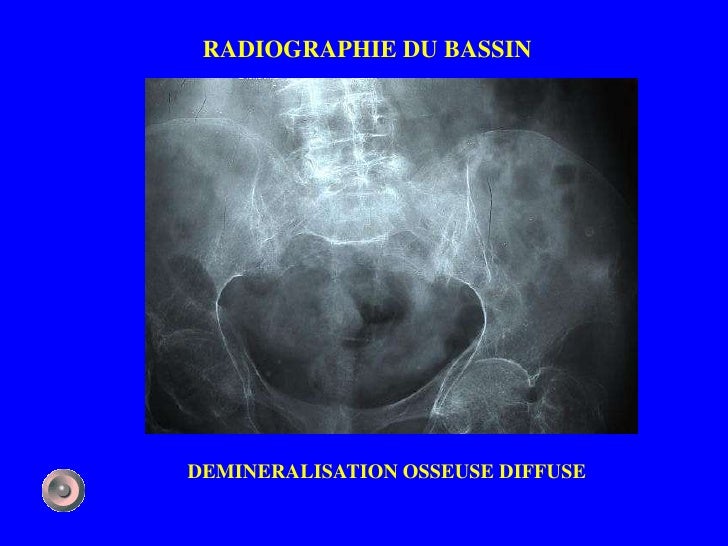 1 anatomie et semiologie rdiologique (version 2)