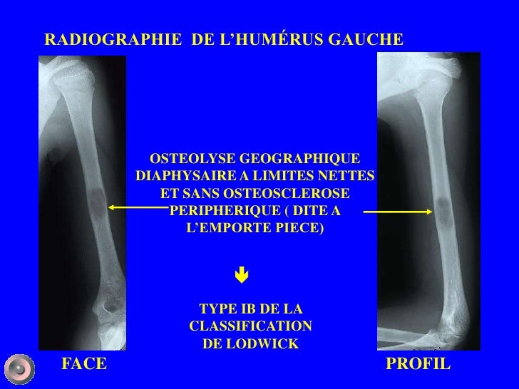 1 anatomie et semiologie rdiologique (version 2)