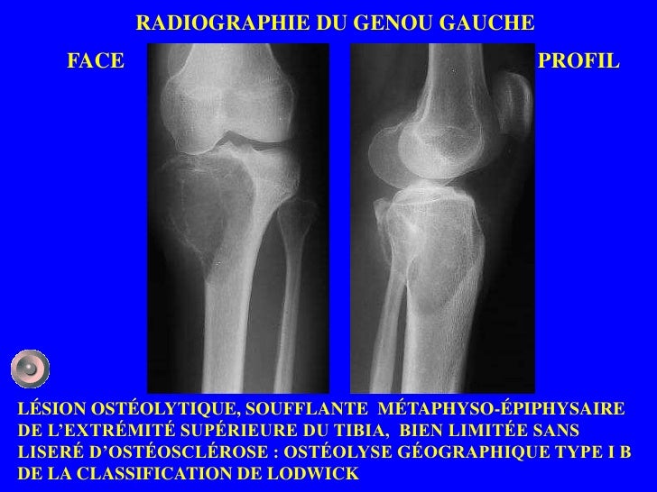1 anatomie et semiologie rdiologique (version 2)
