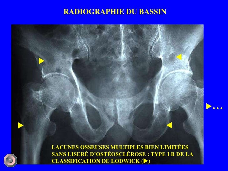 1 anatomie et semiologie rdiologique (version 2)
