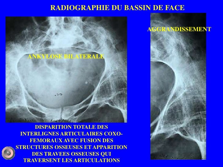 1 anatomie et semiologie rdiologique (version 2)