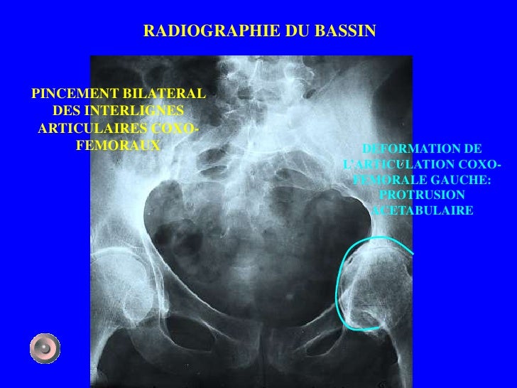 1 anatomie et semiologie rdiologique (version 2)