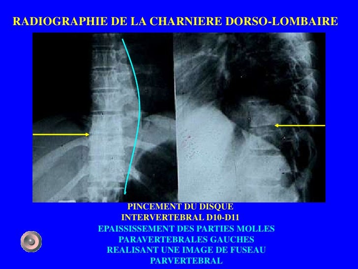 1 anatomie et semiologie rdiologique (version 3)