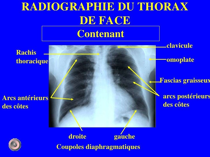 1 anatomie et semiologie rdiologique (version 3)