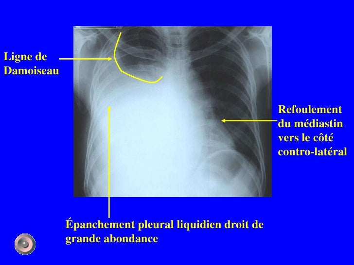 1 anatomie et semiologie rdiologique (version 3)