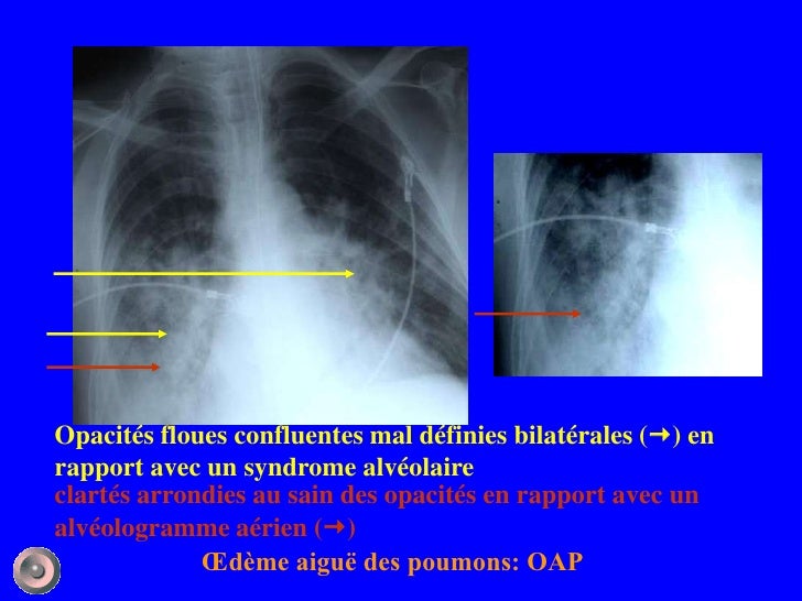 1 anatomie et semiologie rdiologique (version 3)