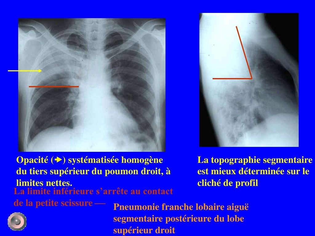 1 anatomie et semiologie rdiologique (version 3)