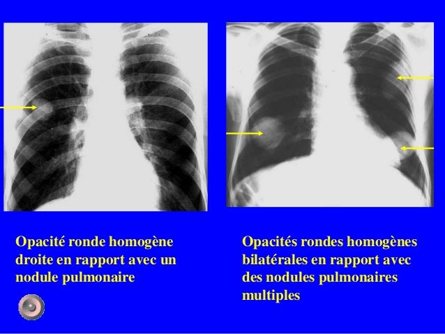 Anatomie ostéologie