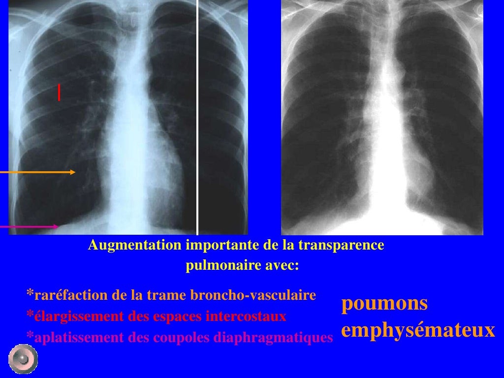 1 anatomie et semiologie rdiologique (version 4)