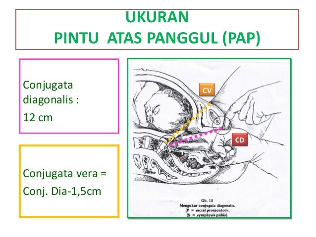 anatomi genitalia (internal dan eksternal)
