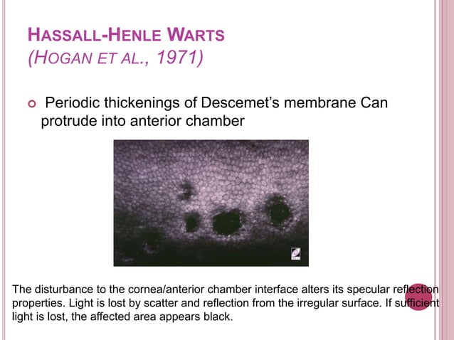 1 Anatomy(Ant.segment-1) .pptx
