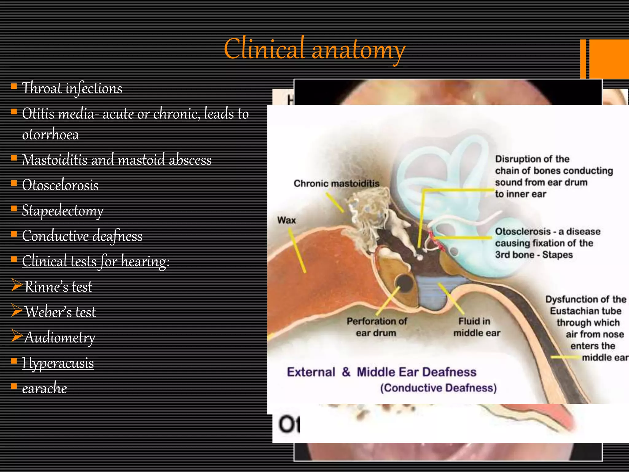 anatomy of ear | PPTX
