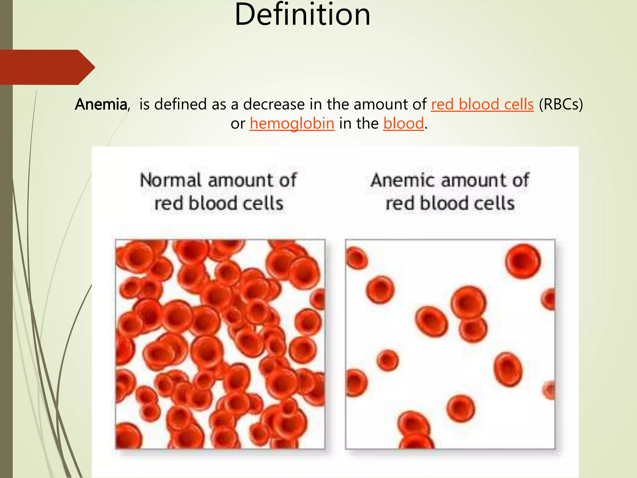 Anemia 101 | PPT