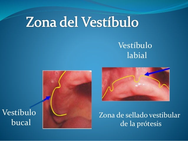 Análisis anatómico y fisiológico del paciente totalmente edéntulo