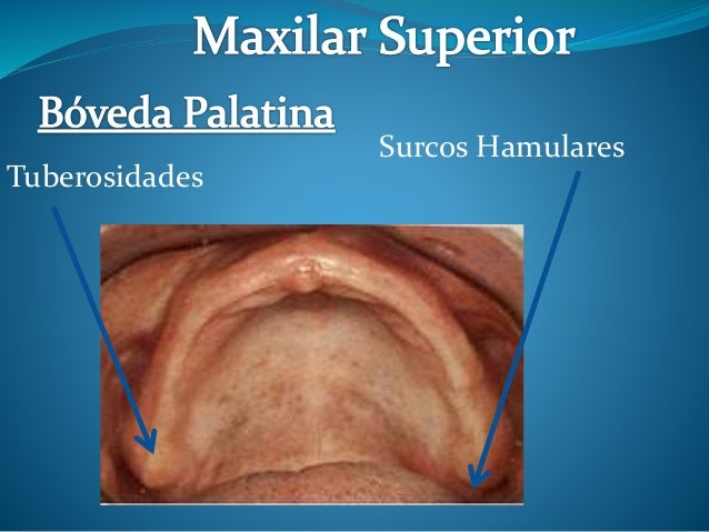 Análisis anatómico y fisiológico del paciente totalmente edéntulo