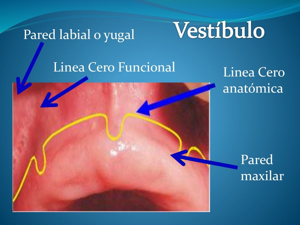 Análisis anatómico y fisiológico del paciente totalmente edéntulo