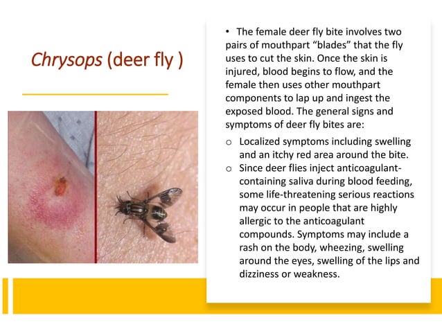 1 arthropod allergy.pptx