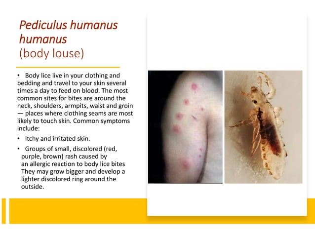 1 arthropod allergy.pptx