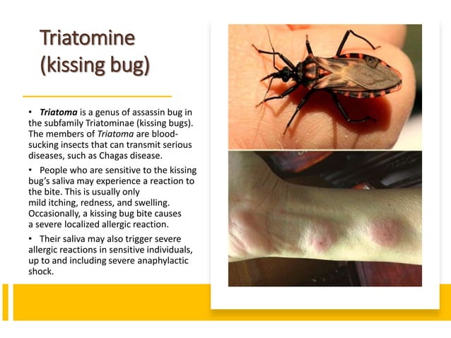 1 arthropod allergy.pptx