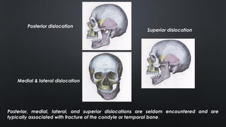 Acute Dislocation temporomandibular joint | PDF