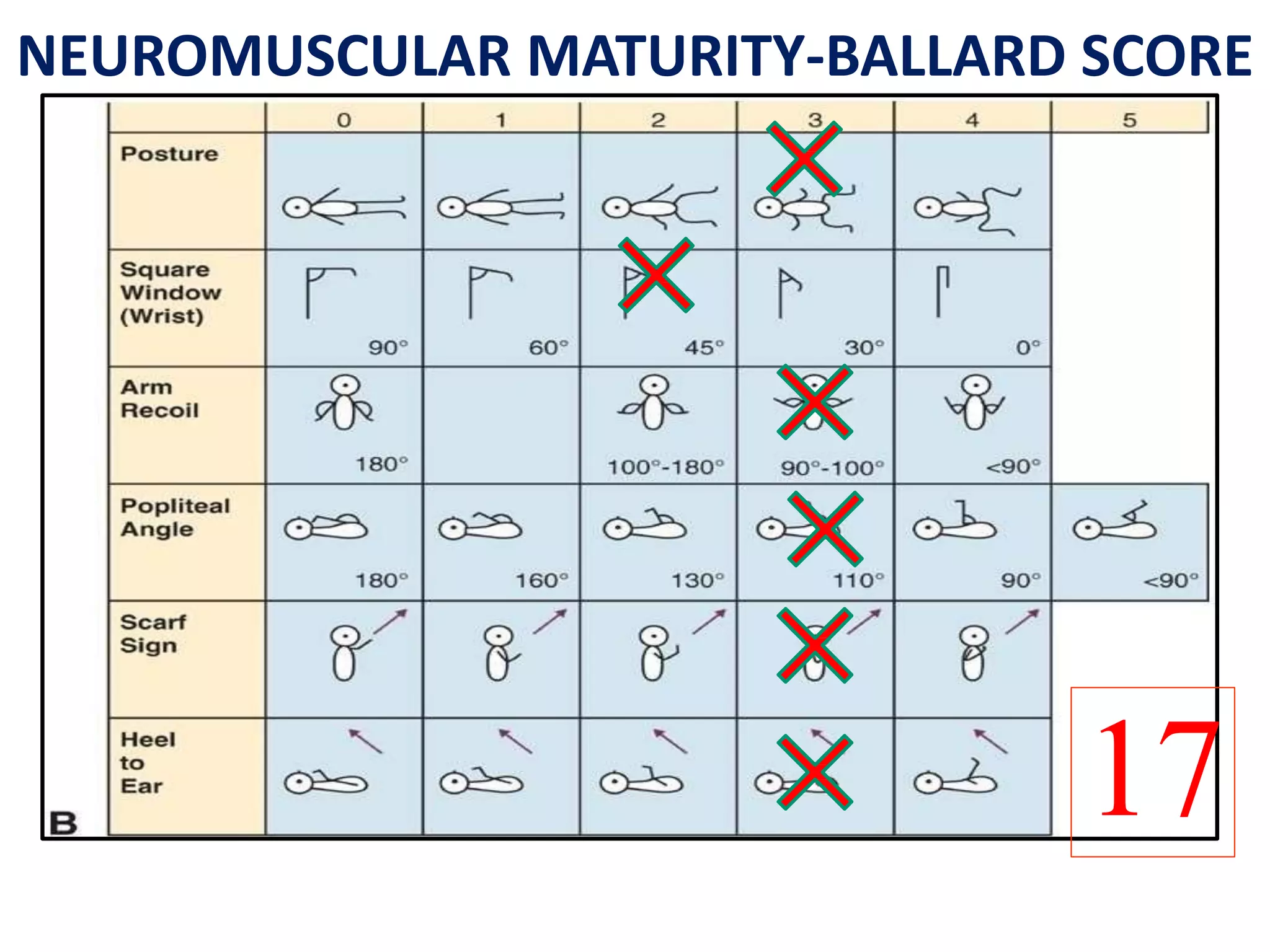 ASSESSMENT OF NEWBORN REFLEXES | PPTX