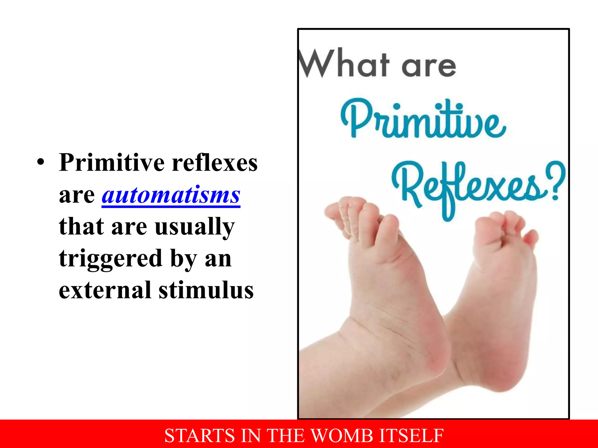 ASSESSMENT OF NEWBORN REFLEXES | PPTX
