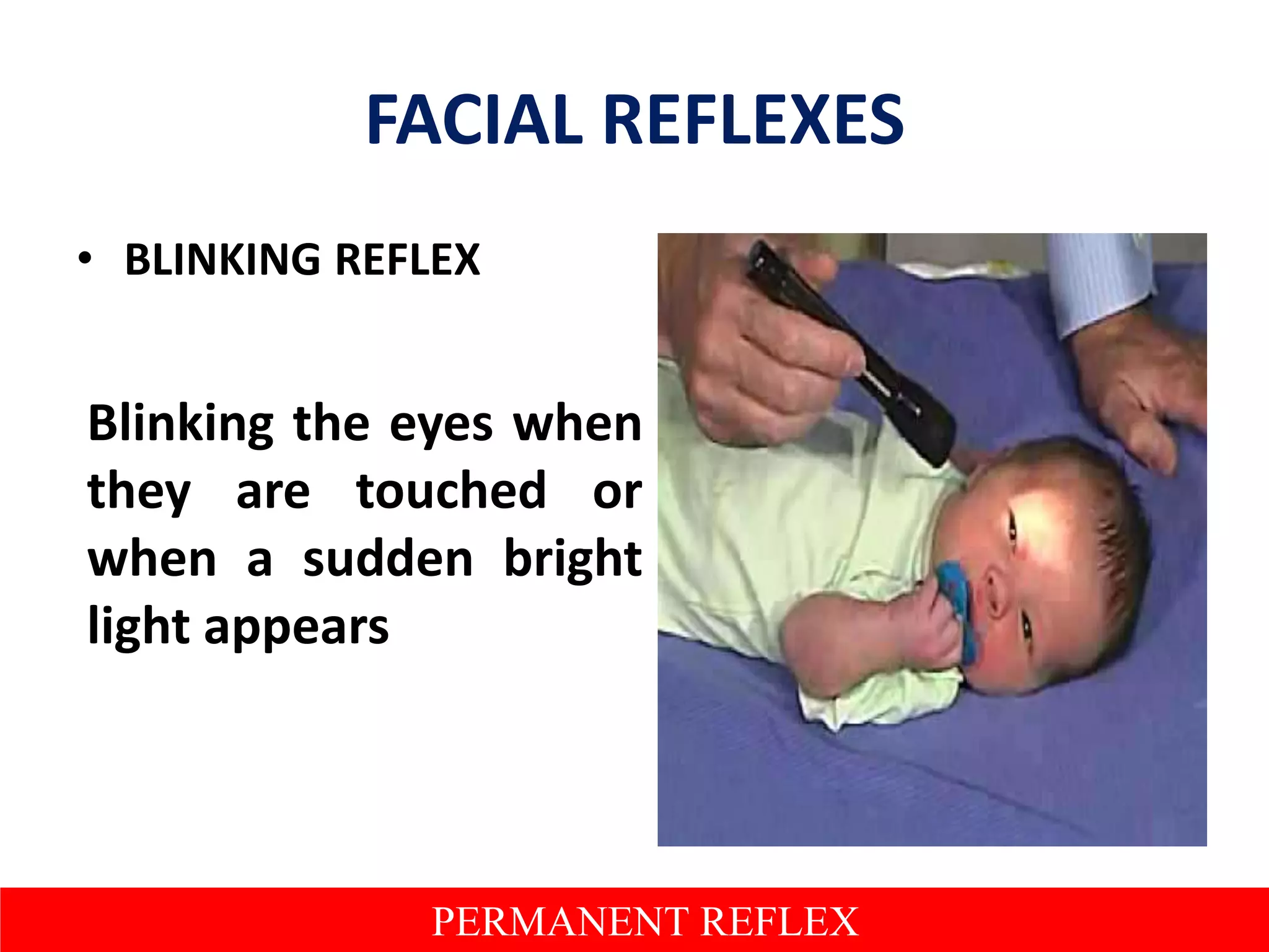 ASSESSMENT OF NEWBORN REFLEXES | PPTX