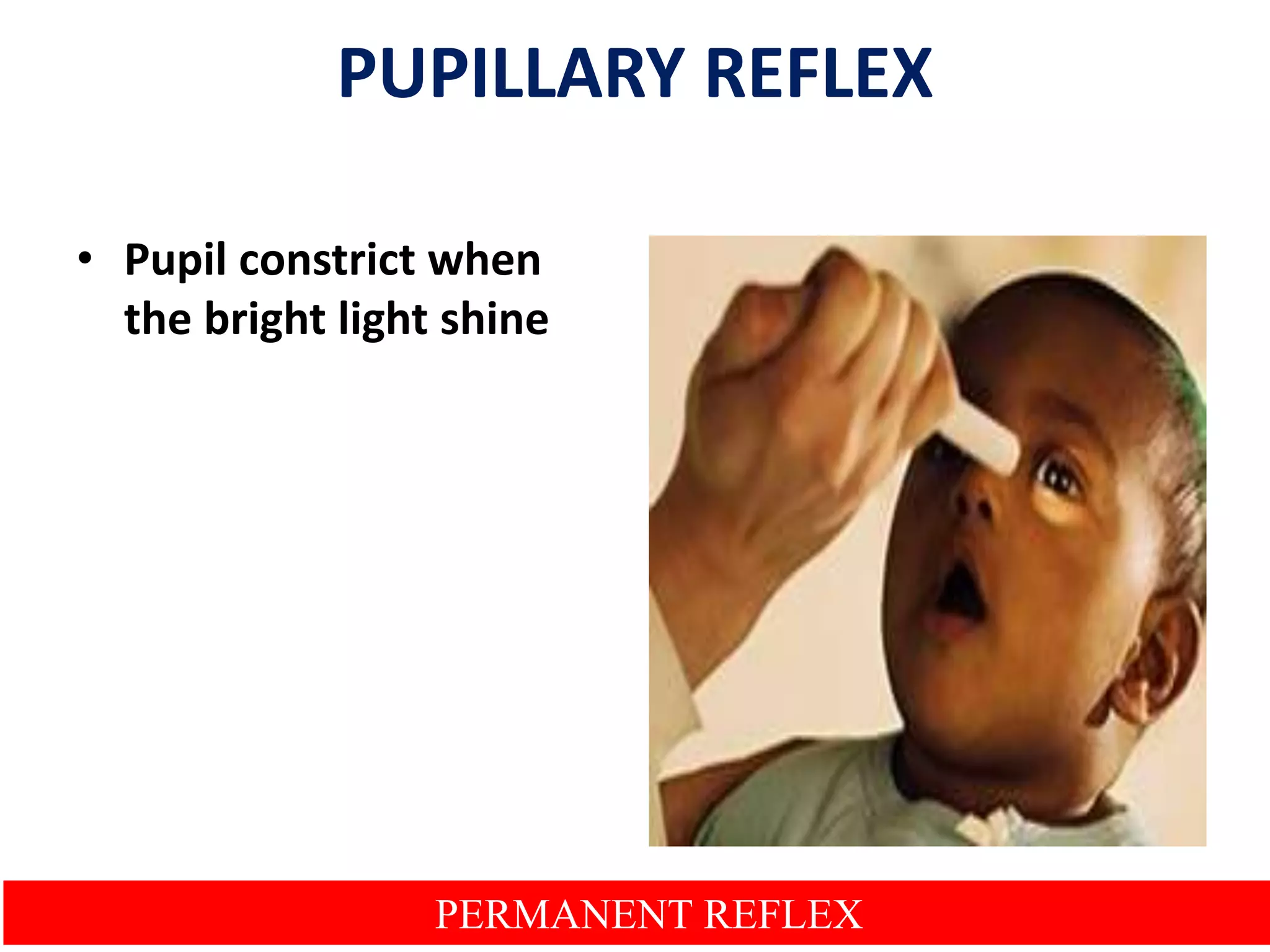 ASSESSMENT OF NEWBORN REFLEXES | PPTX