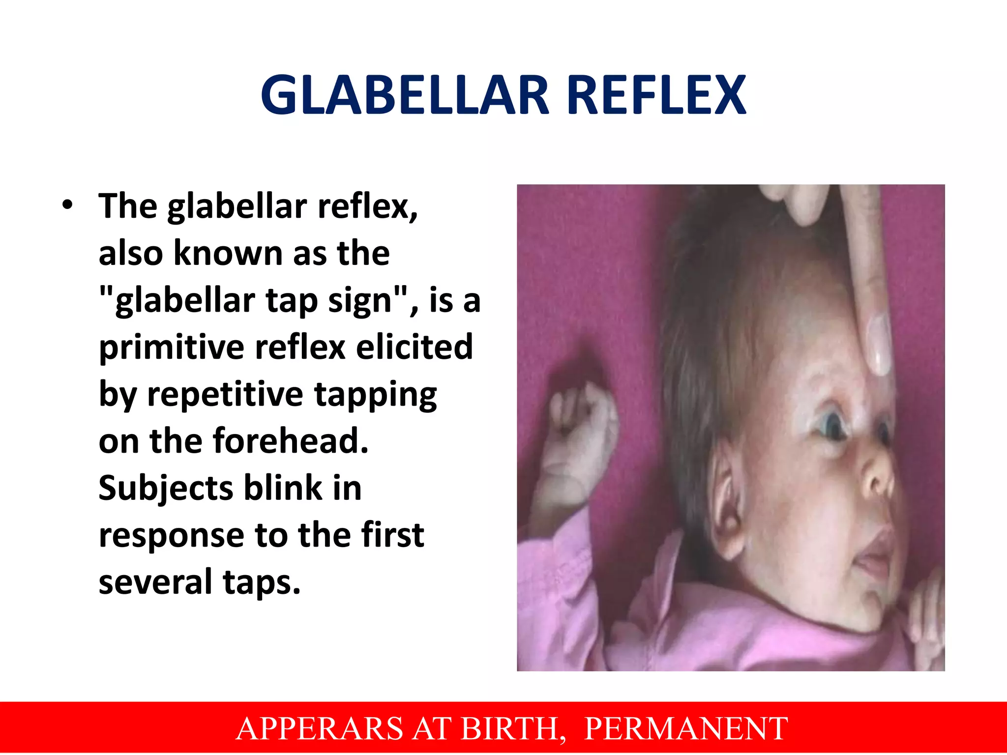 ASSESSMENT OF NEWBORN REFLEXES | PPTX