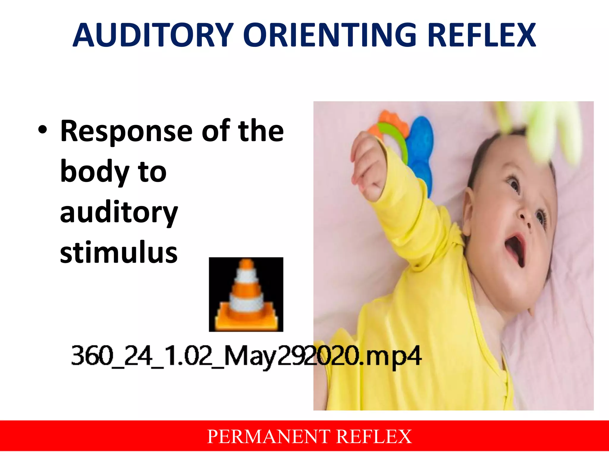 ASSESSMENT OF NEWBORN REFLEXES | PPTX