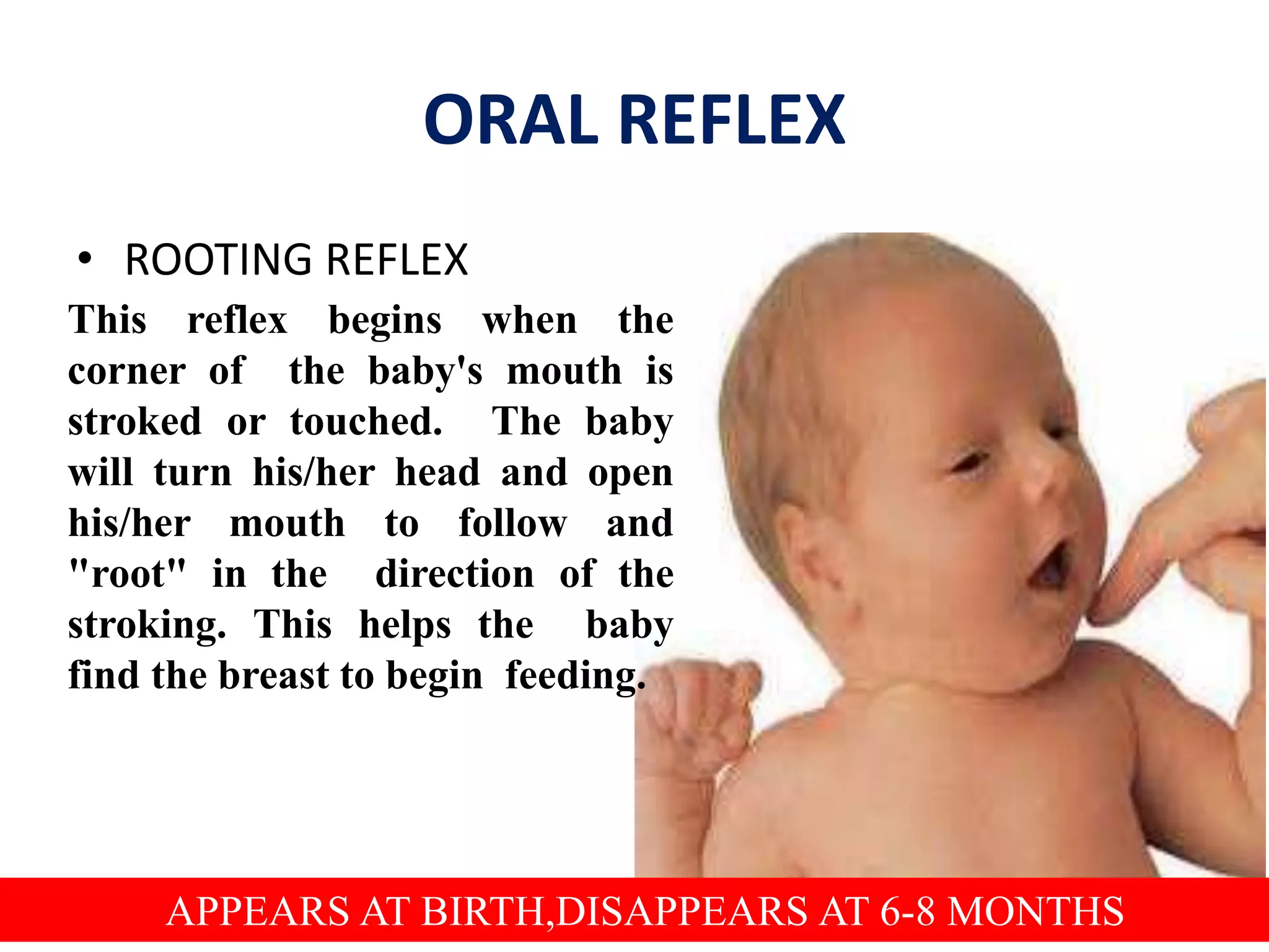 ASSESSMENT OF NEWBORN REFLEXES | PPTX