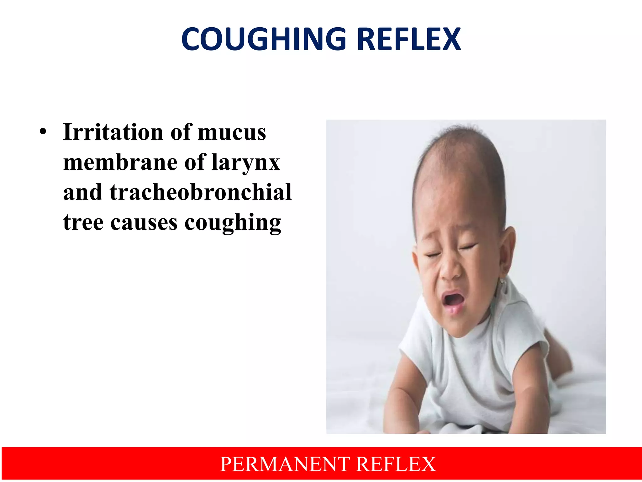 ASSESSMENT OF NEWBORN REFLEXES | PPTX