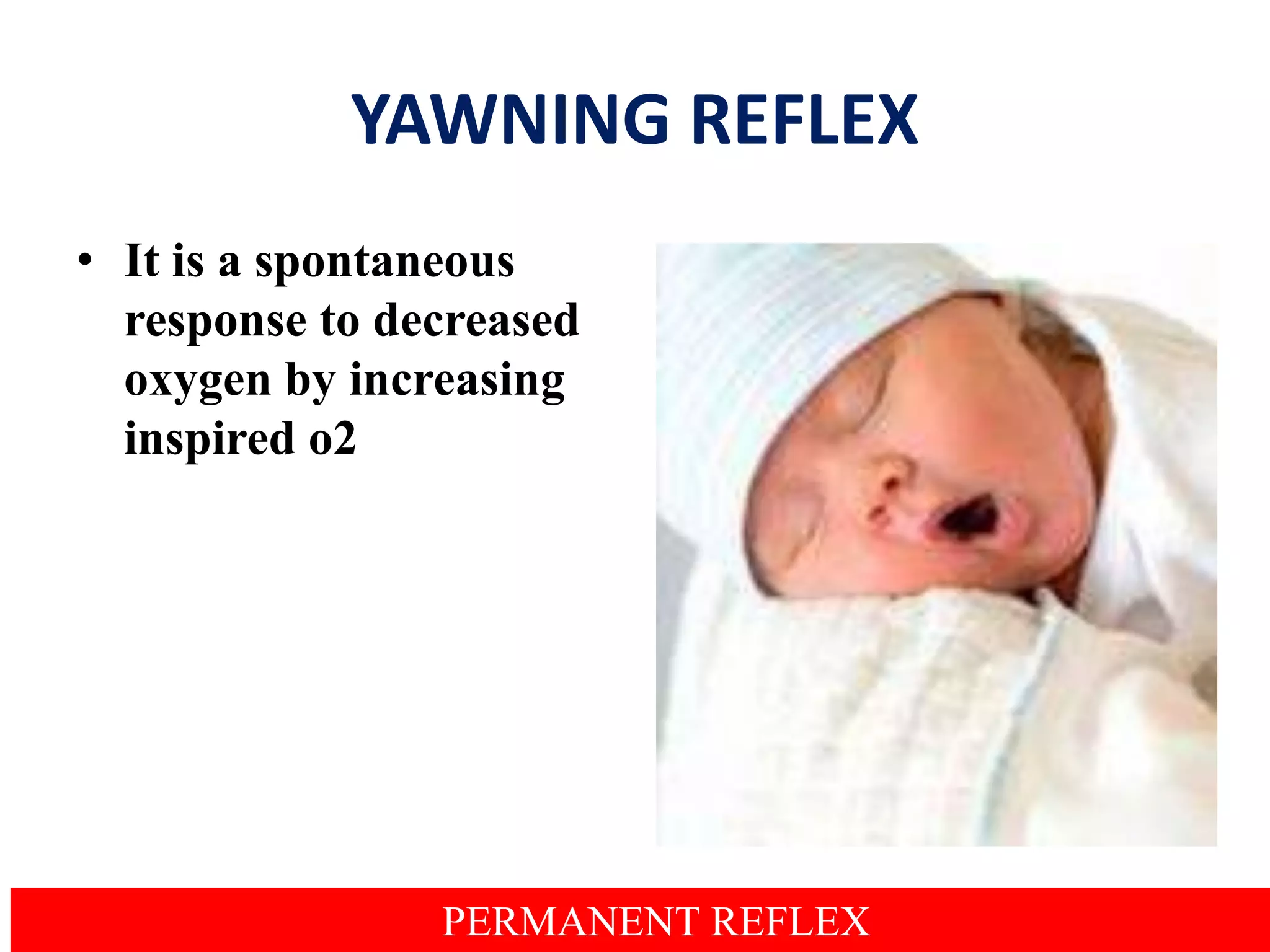 ASSESSMENT OF NEWBORN REFLEXES | PPTX