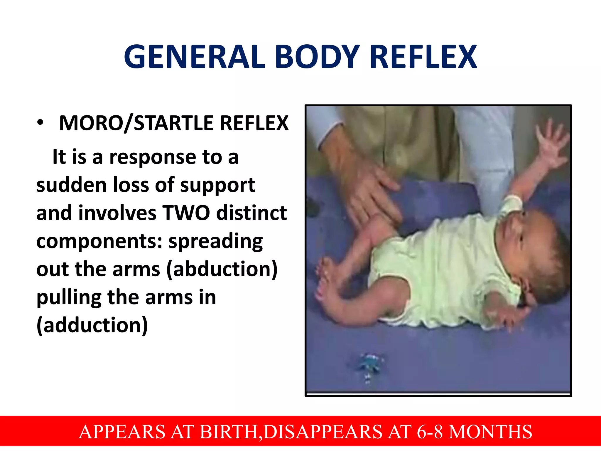 ASSESSMENT OF NEWBORN REFLEXES | PPTX