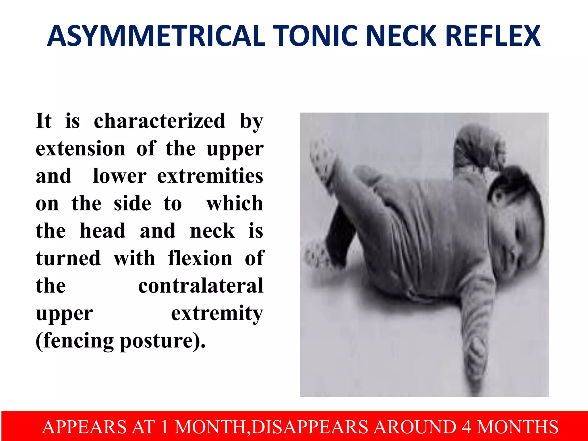 ASSESSMENT OF NEWBORN REFLEXES | PPT