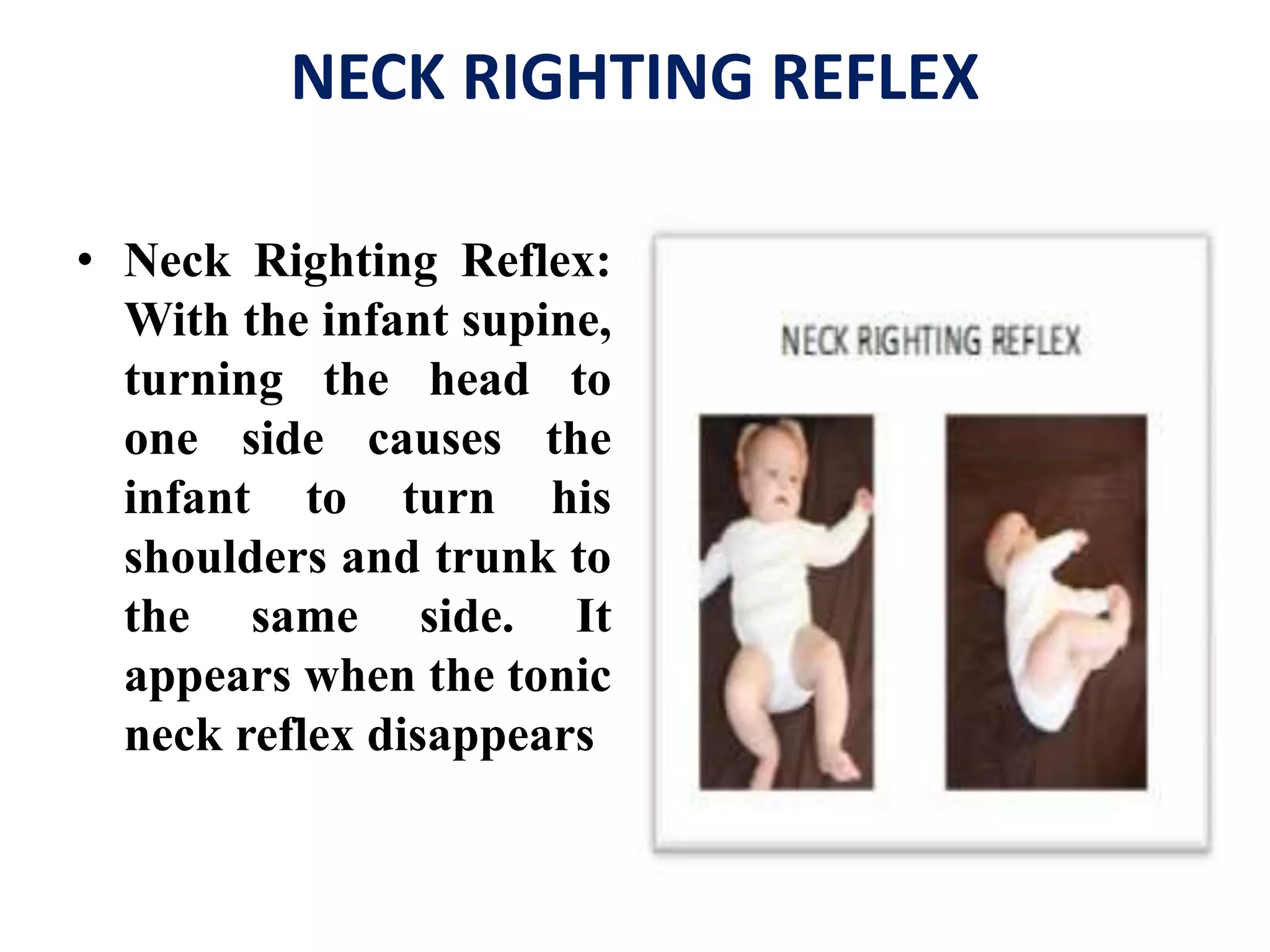 ASSESSMENT OF NEWBORN REFLEXES | PPTX