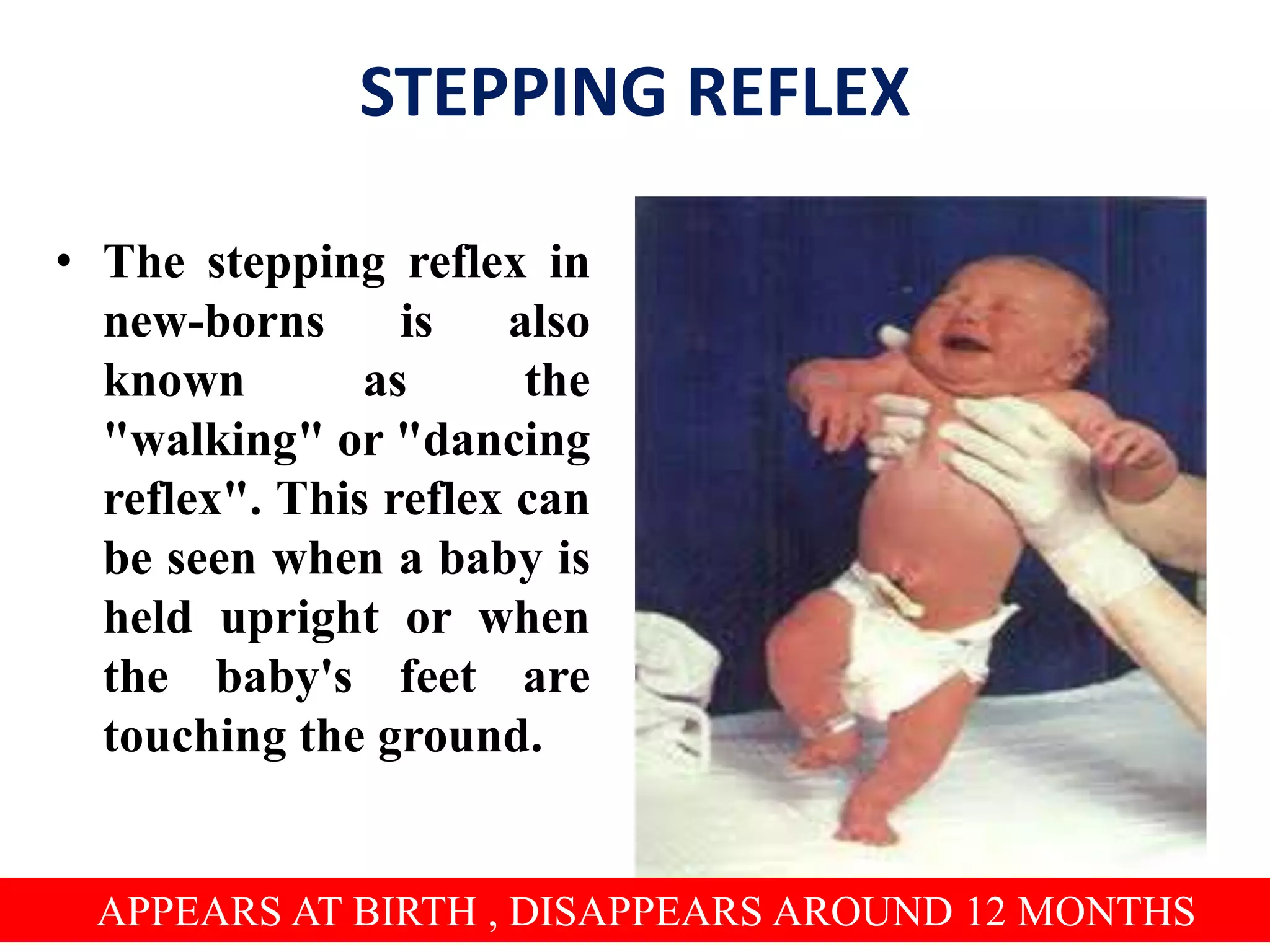 ASSESSMENT OF NEWBORN REFLEXES | PPTX