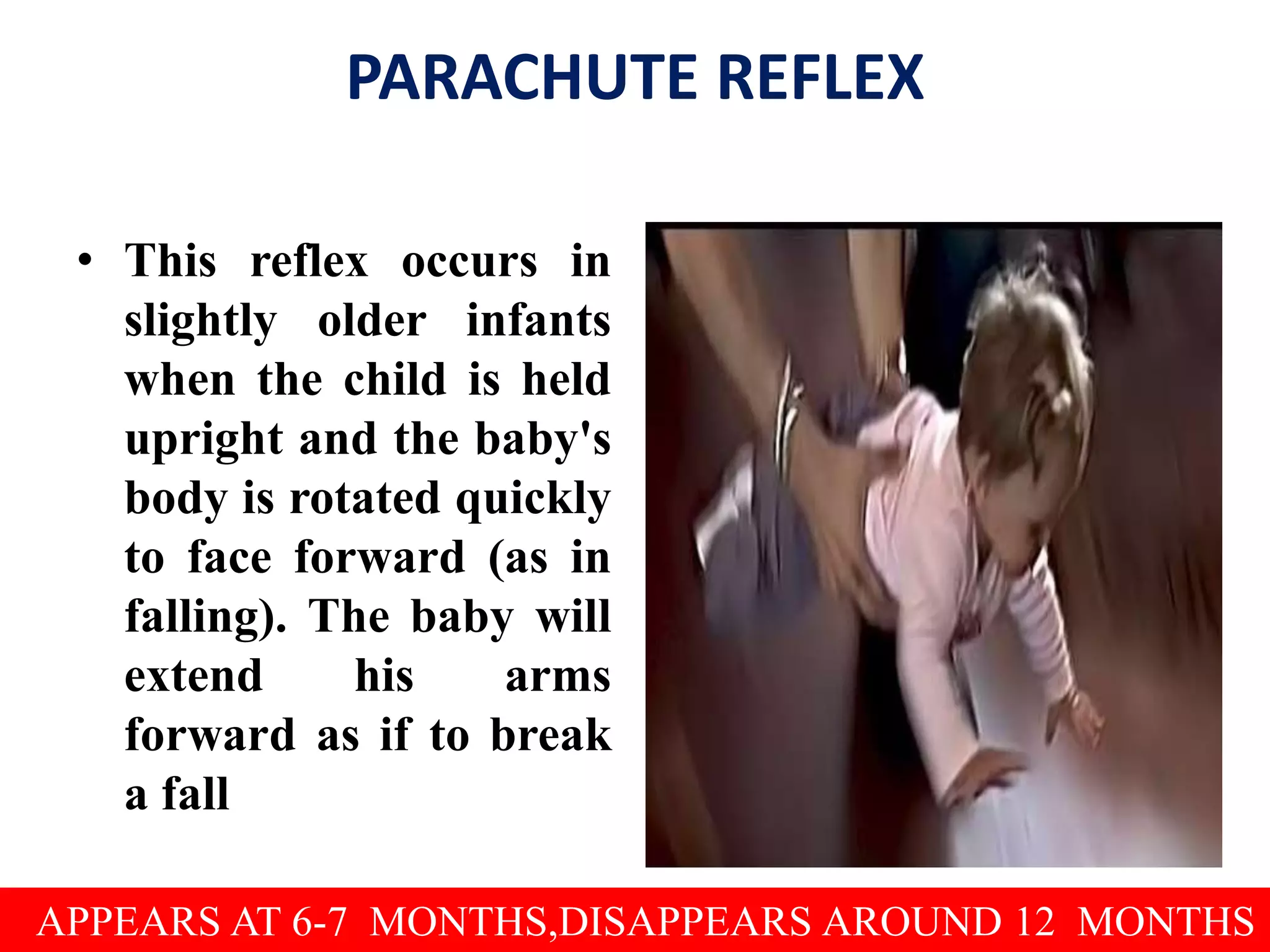 ASSESSMENT OF NEWBORN REFLEXES | PPTX
