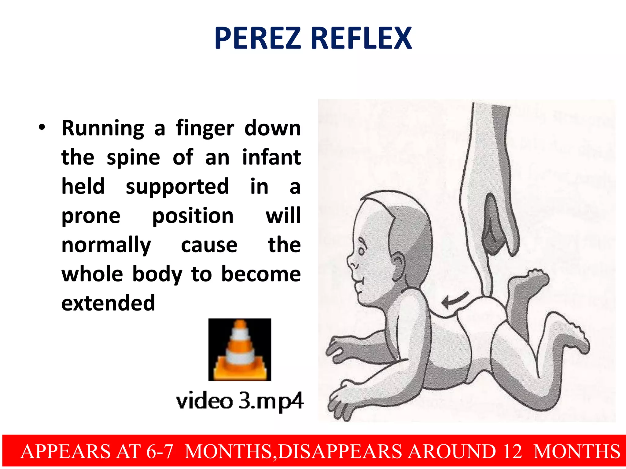 ASSESSMENT OF NEWBORN REFLEXES | PPTX