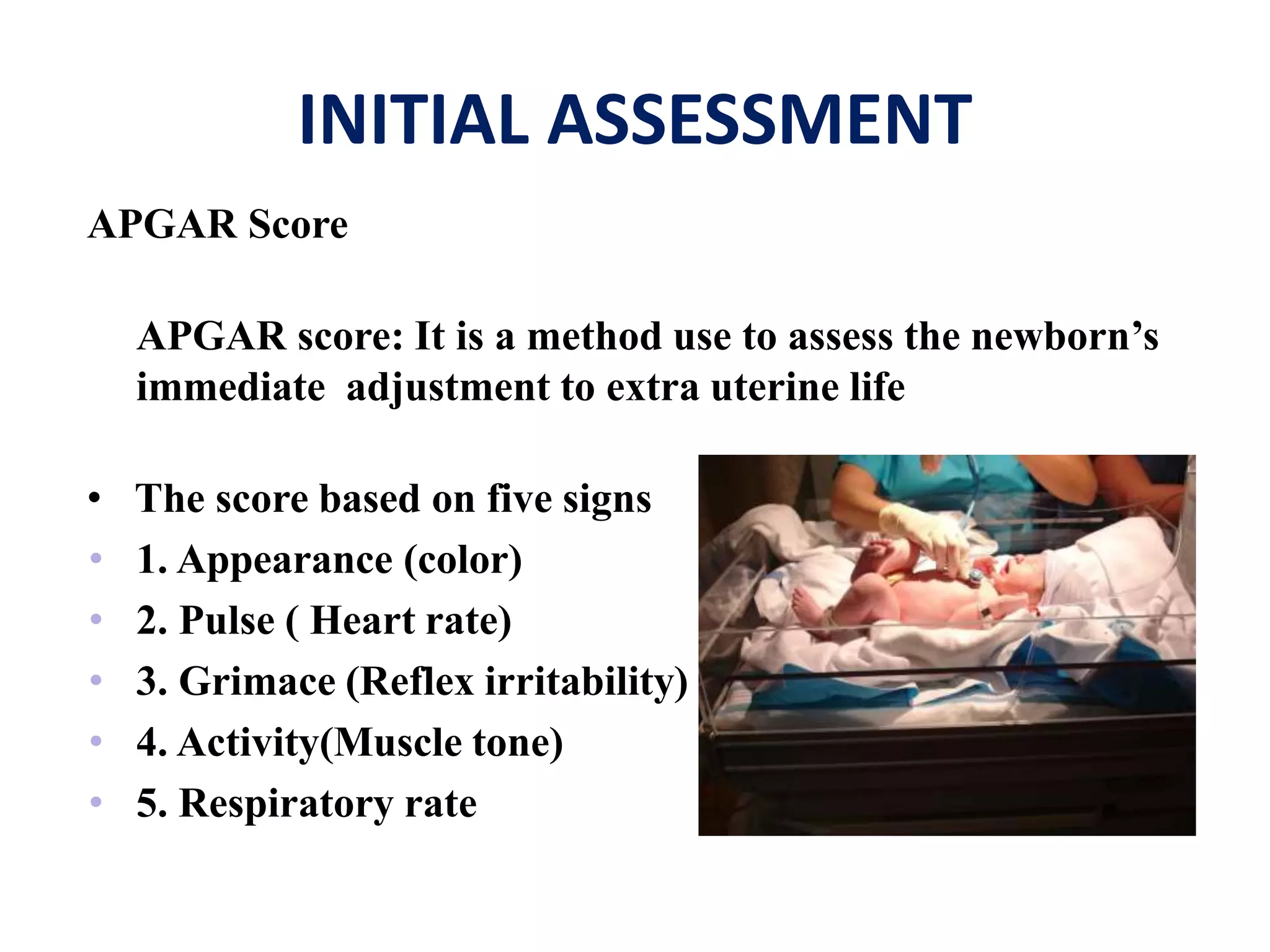 ASSESSMENT OF NEWBORN REFLEXES | PPTX