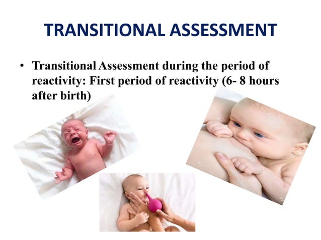 ASSESSMENT OF NEWBORN REFLEXES | PPTX