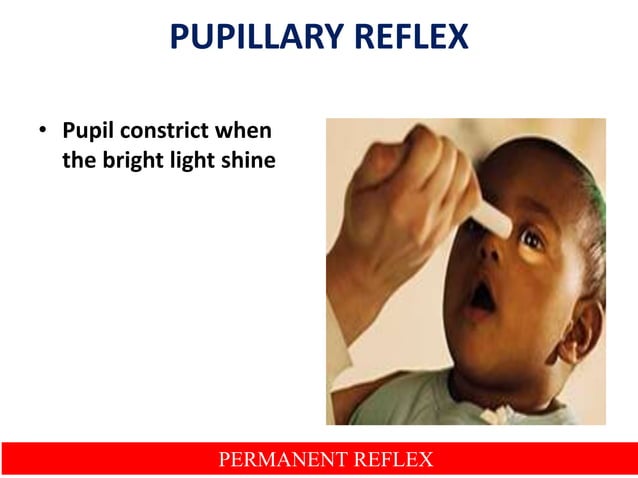 ASSESSMENT OF NEWBORN REFLEXES | PPTX