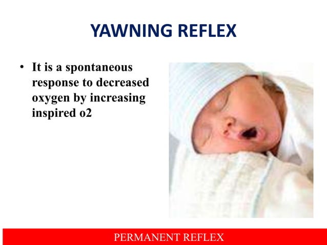ASSESSMENT OF NEWBORN REFLEXES | PPTX